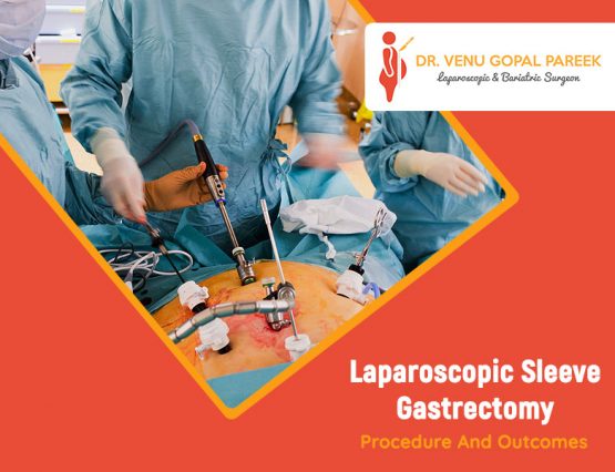 Laparoscopic sleeve gastrectomy surgery Archives - Dr. V Pareek
