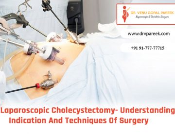 Laparoscopic Appendicitis Surgery Archives - Dr. V Pareek