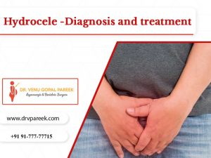 Hydrocele -Diagnosis And Treatment