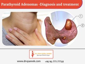 Parathyroid Adenomas Diagnosis And Treatment