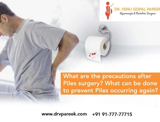 Piles Surgery in Hyderabad Archives - Dr. V Pareek