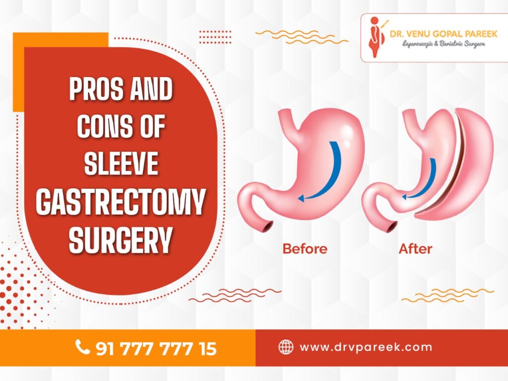 Pros and Cons of sleeve Gastrectomy Surgery