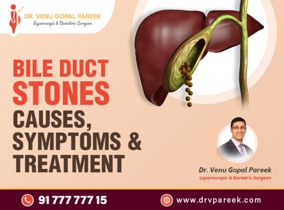 Bile Duct Stones - Causes, Symptoms and Treatment