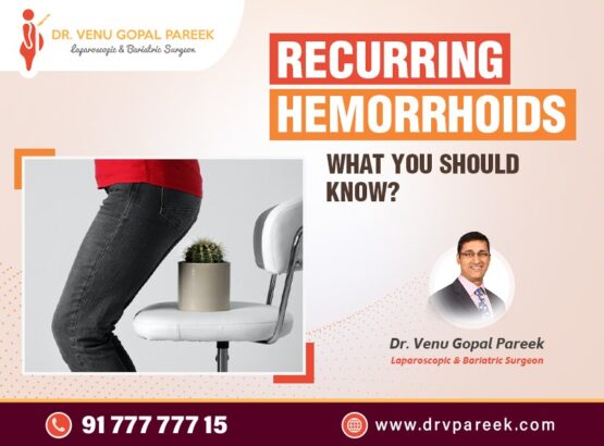 Recurring Hemorrhoids - What you should know