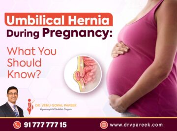 Umbilical Hernia During Pregnancy: What You Should Know