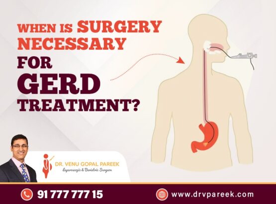 When Is Surgery Necessary for GERD Treatment?