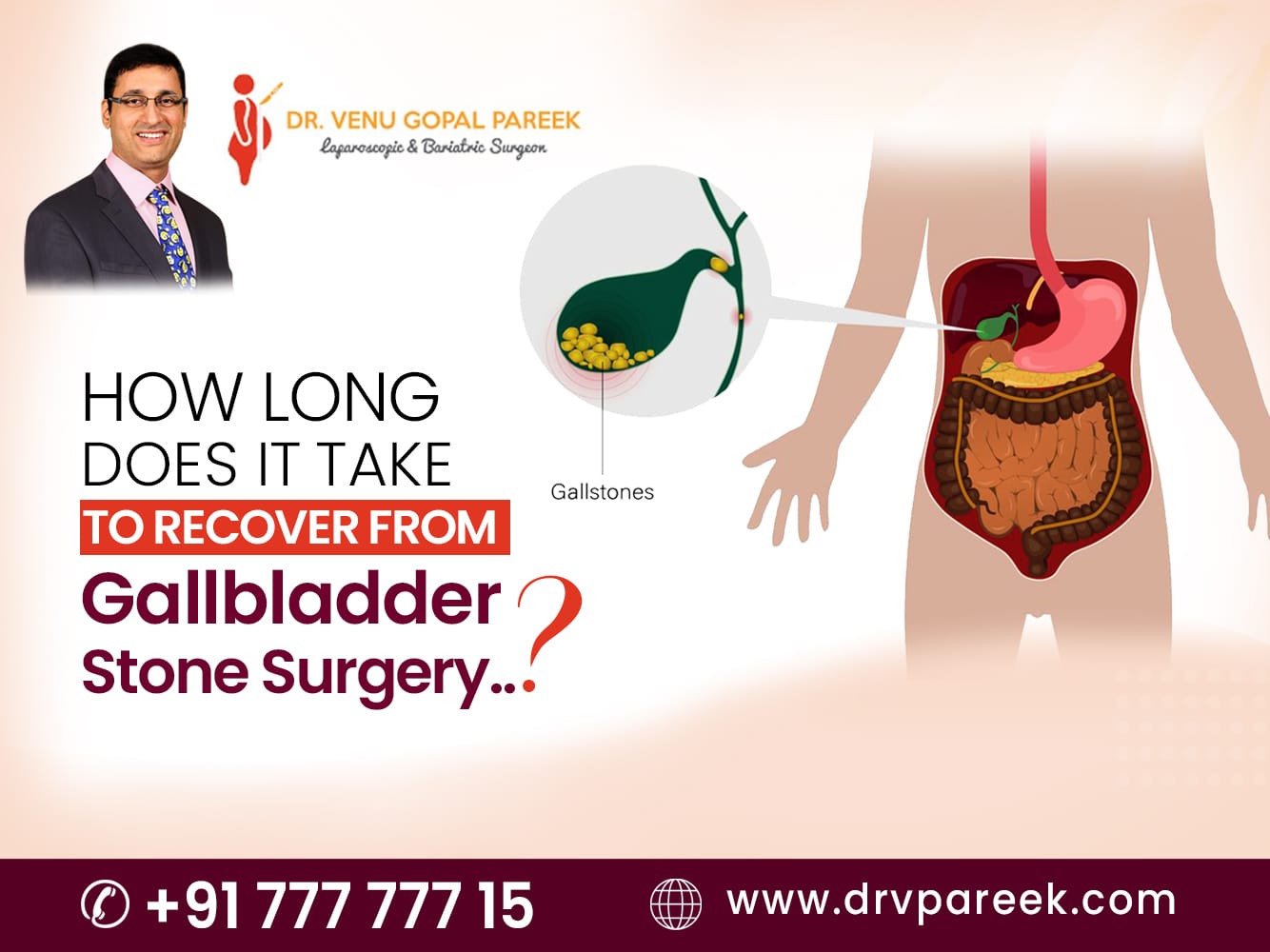 Gallbladder Stones Treatment Without Operation