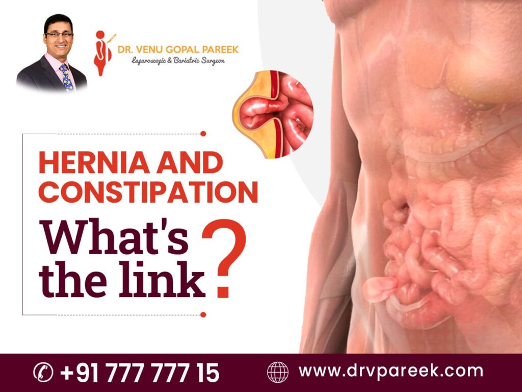Hernia and constipation: What's the link?