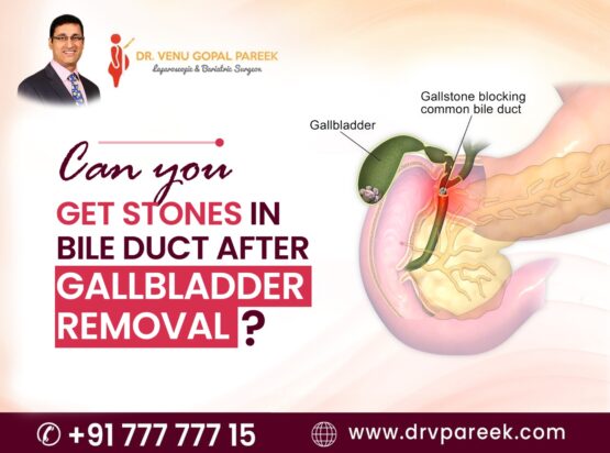 Can you get stones in the bile duct after gallbladder removal