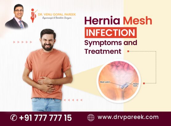 Hernia mesh infection Symptoms and Treatment