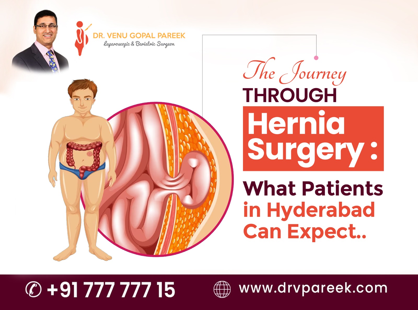 The Journey Through Hernia Surgery: What Patients in Hyderabad Can Expect