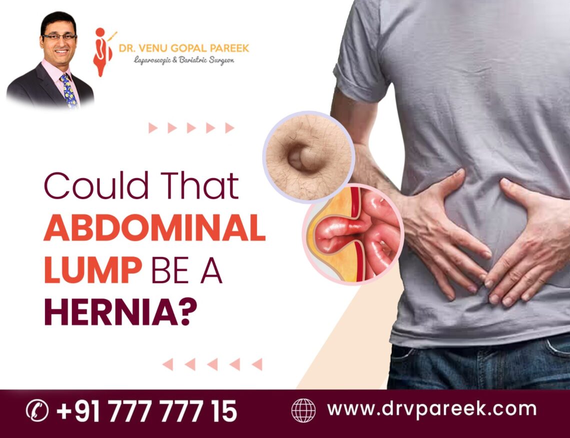 Umbilical Hernia During Pregnancy: What You Should Know