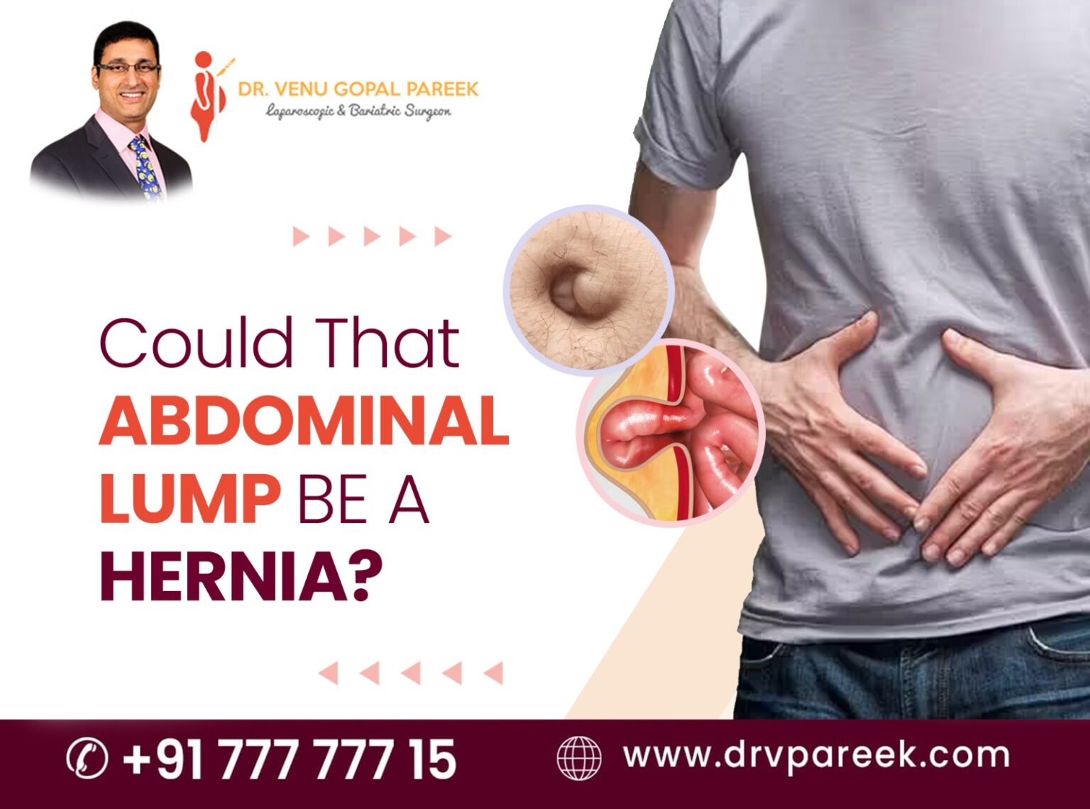 Could that abdominal lump be a hernia?